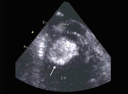 Tumors, Masses and infection - A Practical Approach to Clinical ...
