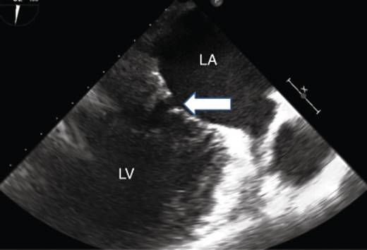 Chapter 24 - Echocardiography Board Review: 500 Multiple Choice ...