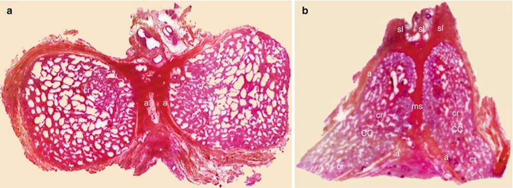 Structure of the Bulbo-clitoral Organ - Anatomic Study of the Clitoris ...