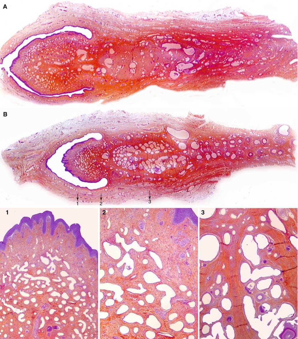 Structure of the Bulbo-clitoral Organ - Anatomic Study of the Clitoris ...