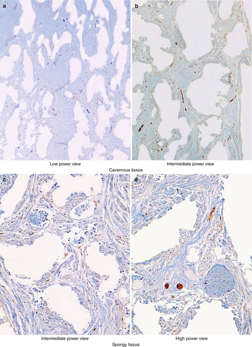 Physiology of Cavernous and Spongy Tissues - Anatomic Study of the ...