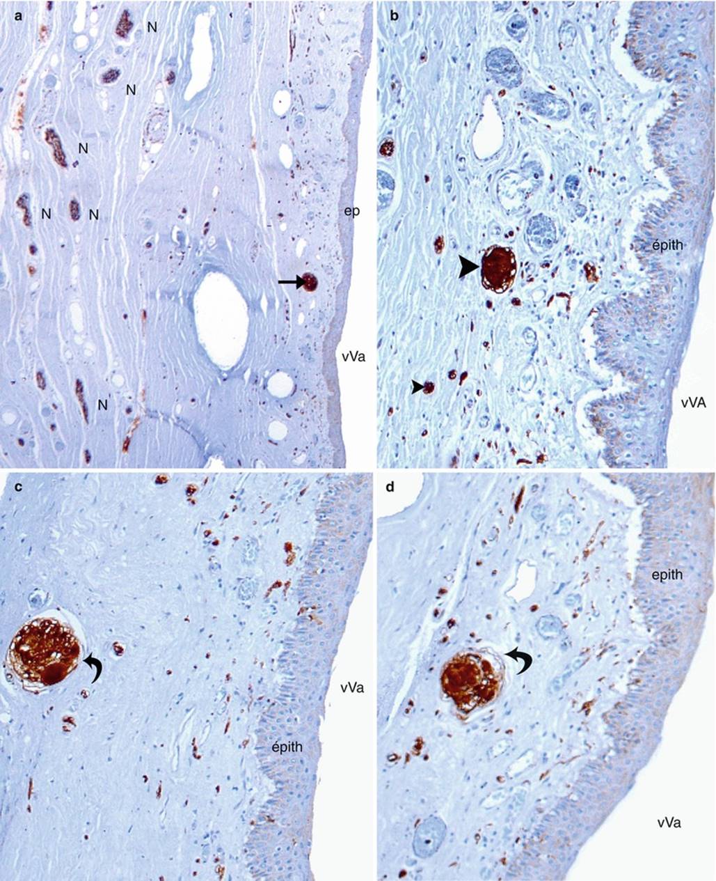 Sensory Corpuscles - Anatomic Study of the Clitoris and the Bulbo ...
