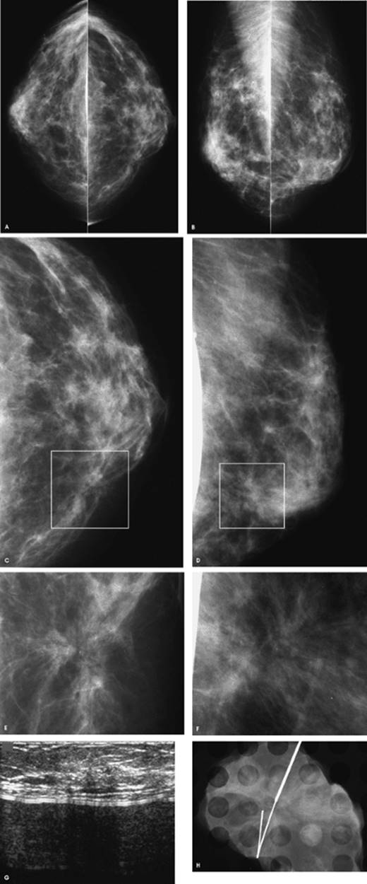 Diagnostic Breast Imaging - Clinical Breast Imaging: A Patient Focused ...