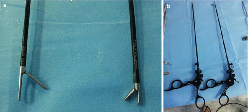 Role of Laparoscopic Ovarian Drilling in Polycystic Ovarian Syndrome ...