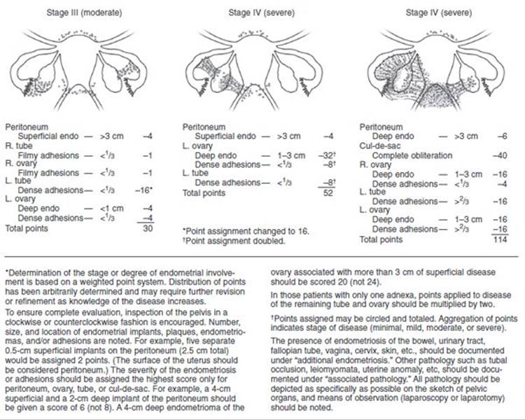 Endometriosis - Obstetrics and Gynecology 7 Ed.