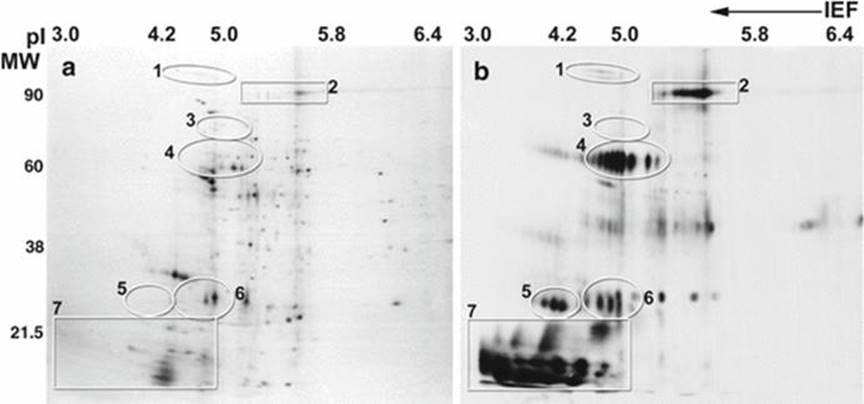 Methods of Analysis of Sperm Antigens Related to Fertility - Immune ...