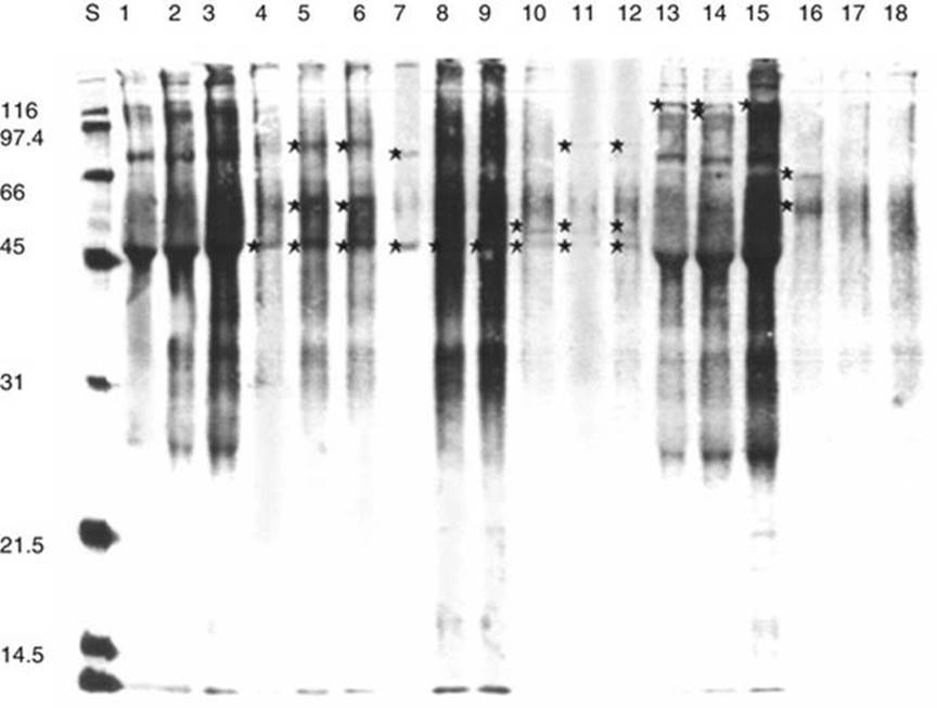 Immune Chemistry of ASA - Immune Infertility: Impact of Immune ...