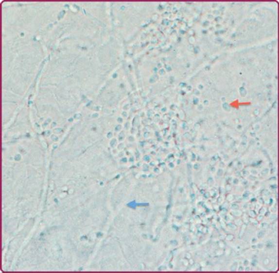 Pelvic Infections - Review of Medical Microbiology and Immunology, 13th ...
