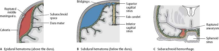 Brain & Spinal Cord - Atlas of Anatomy