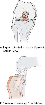 Knee & Leg - Atlas of Anatomy