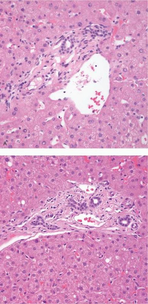 Anatomic Considerations - Biopsy Interpretation of the Liver, 2nd ed