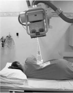 Basic Principles of Radiography and Digital Technology - Clark's ...