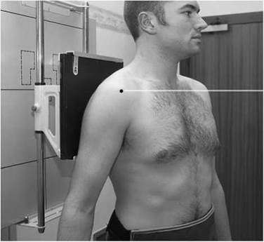 The Upper Limb - Clark's Positioning In Radiography - by A. S. Whitley