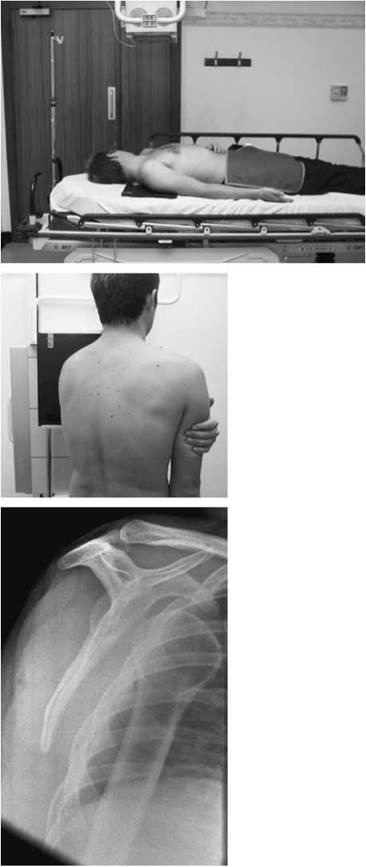The Shoulder - Clark's Positioning In Radiography - by A. S. Whitley