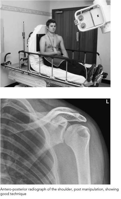 The Shoulder - Clark's Positioning In Radiography - by A. S. Whitley