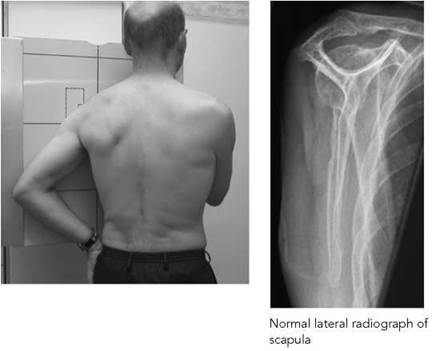 The Shoulder - Clark's Positioning In Radiography - by A. S. Whitley