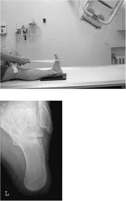 The Lower Limb - Clark's Positioning In Radiography - by A. S. Whitley