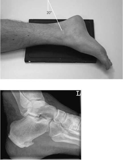 The Lower Limb - Clark's Positioning In Radiography - by A. S. Whitley