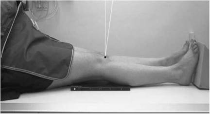 The Lower Limb - Clark's Positioning In Radiography - by A. S. Whitley