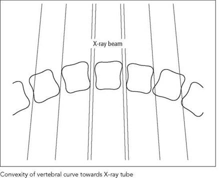 The Vertebral Column - Clark's Positioning In Radiography - by A. S ...