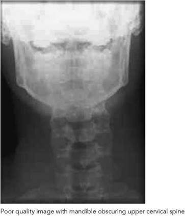 The Vertebral Column - Clark's Positioning In Radiography - by A. S ...