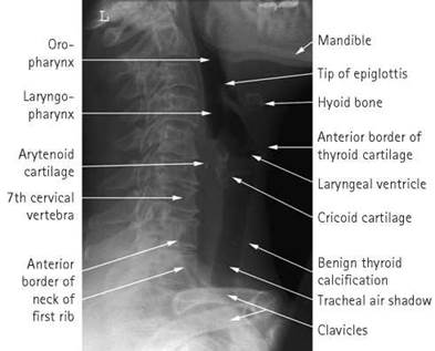 The Thorax and Upper Airways - Clark's Positioning In Radiography - by ...