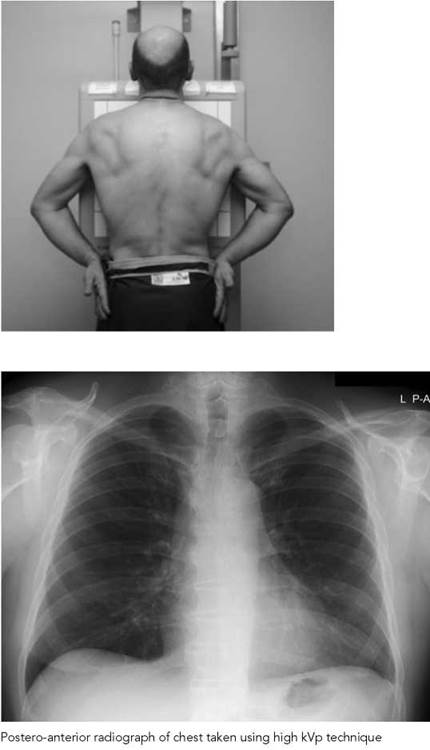 Rao Sternum Breathing Technique
