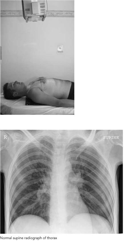 The Thorax and Upper Airways - Clark's Positioning In Radiography - by ...