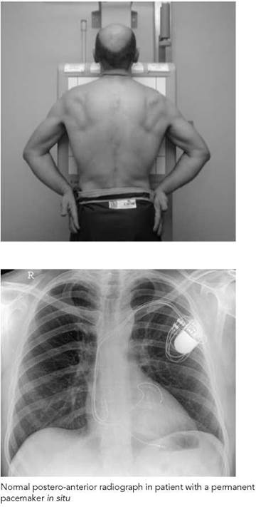 The Thorax and Upper Airways - Clark's Positioning In Radiography - by ...