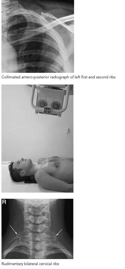 The Thorax and Upper Airways - Clark's Positioning In Radiography - by ...