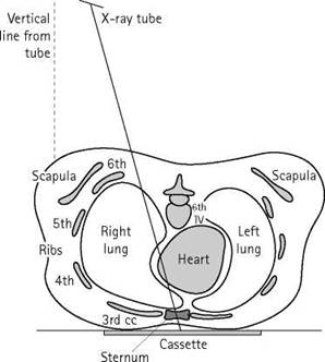 The Thorax and Upper Airways - Clark's Positioning In Radiography - by ...