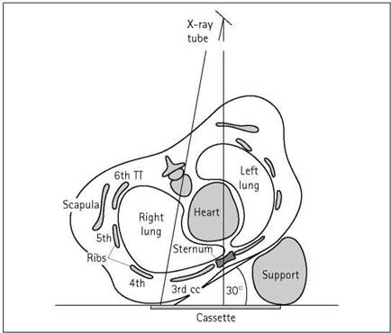The Thorax and Upper Airways - Clark's Positioning In Radiography - by ...