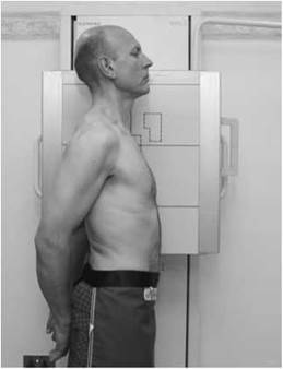 The Thorax and Upper Airways - Clark's Positioning In Radiography - by ...
