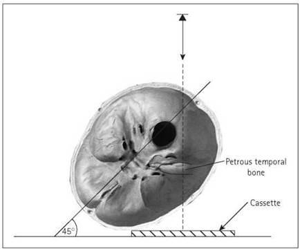 The Skull - Clark's Positioning In Radiography - by A. S. Whitley