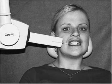 Dental Radiography - Clark's Positioning In Radiography - by A. S. Whitley
