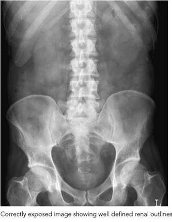 The Abdomen and Pelvic Cavity - Clark's Positioning In Radiography - by ...