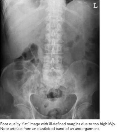 The Abdomen and Pelvic Cavity - Clark's Positioning In Radiography - by ...