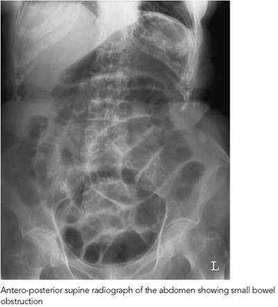 The Abdomen and Pelvic Cavity - Clark's Positioning In Radiography - by ...