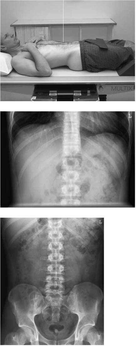 The Abdomen and Pelvic Cavity - Clark's Positioning In Radiography - by ...
