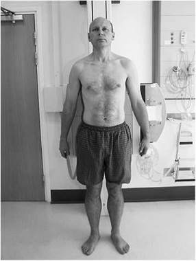 The Abdomen and Pelvic Cavity - Clark's Positioning In Radiography - by ...
