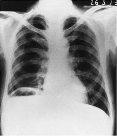 The Abdomen and Pelvic Cavity - Clark's Positioning In Radiography - by ...
