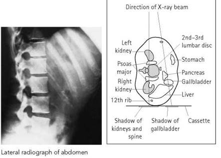 The Abdomen and Pelvic Cavity - Clark's Positioning In Radiography - by ...