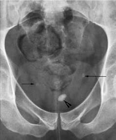 The Abdomen and Pelvic Cavity - Clark's Positioning In Radiography - by ...