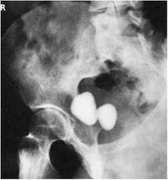The Abdomen and Pelvic Cavity - Clark's Positioning In Radiography - by ...