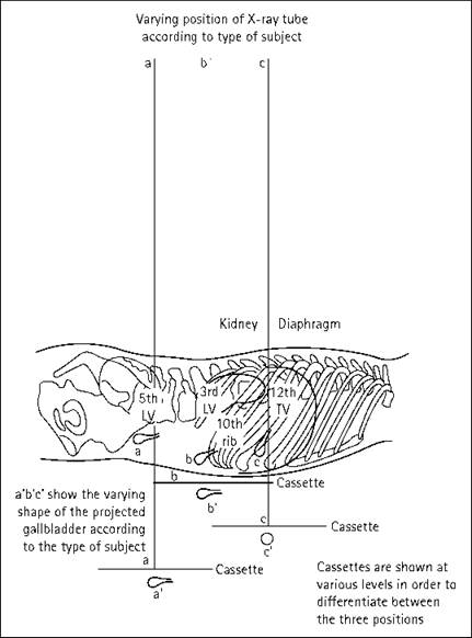 The Abdomen and Pelvic Cavity - Clark's Positioning In Radiography - by ...