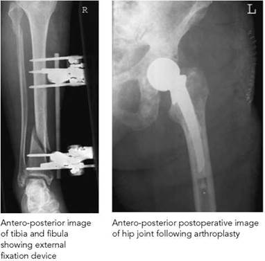 Ward Radiography - Clark's Positioning In Radiography - by A. S. Whitley