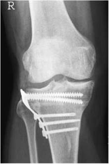 Theatre Radiography - Clark's Positioning In Radiography - by A. S. Whitley