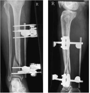 Theatre Radiography - Clark's Positioning In Radiography - by A. S. Whitley