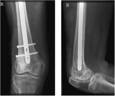 Theatre Radiography - Clark's Positioning In Radiography - by A. S. Whitley