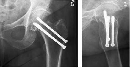 Theatre Radiography - Clark's Positioning In Radiography - by A. S. Whitley